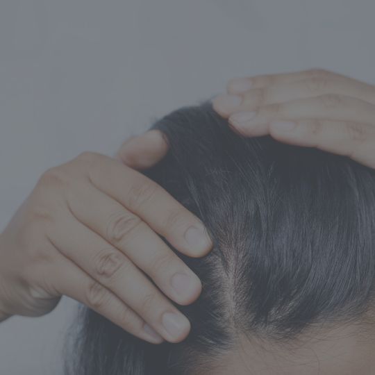 Scalp Psoriasis treatment options V1 - Psoriasis.tech